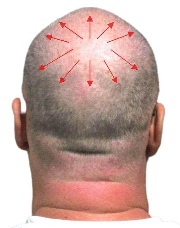 How To Shave Your Head With A Safety Razor - Sharpologist